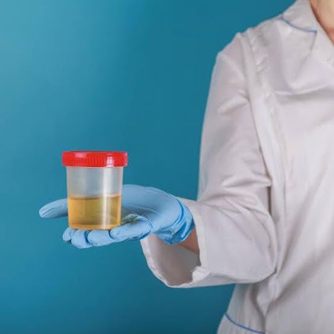 The importance of urine cultures in diagnosing urinary tract infections