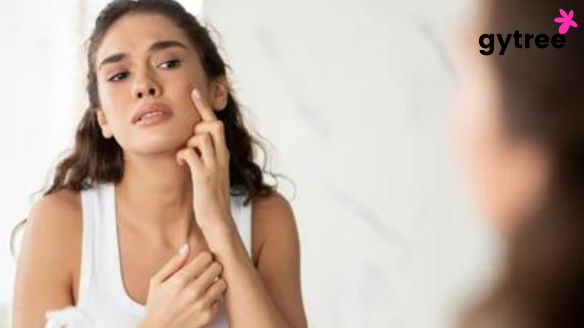 Understanding Skin Health Issues Specific to Women