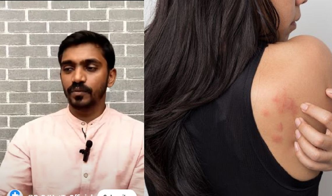 தோல் அரிப்பு, பூச்சி கடிக்கு சூப்பர் தீர்வு… இந்த கீரையில் மஞ்சள் ...