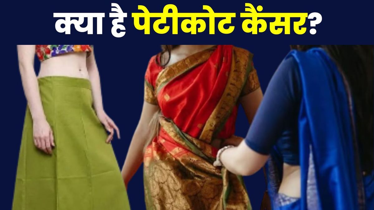 Petticoat Cancer: क्या है पेटीकोट कैंसर, महिलाओं के लिए जारी खौफनाक ...