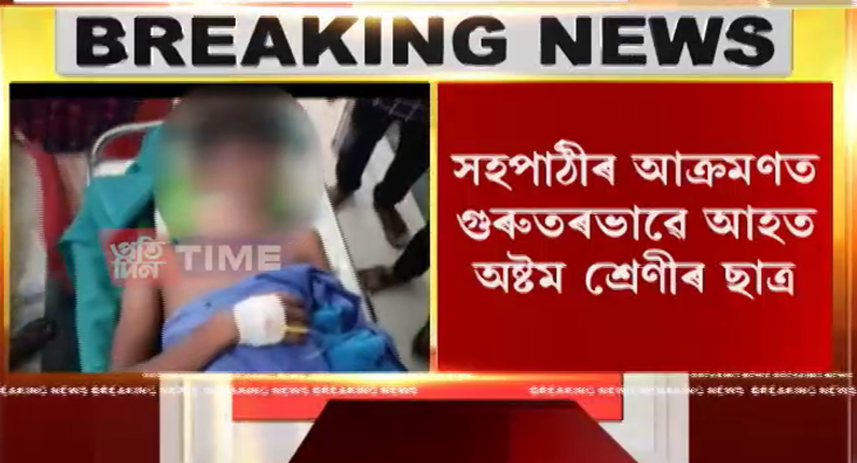 Assam: Class 8 Student Stabbed During Altercation With Peer In Silchar