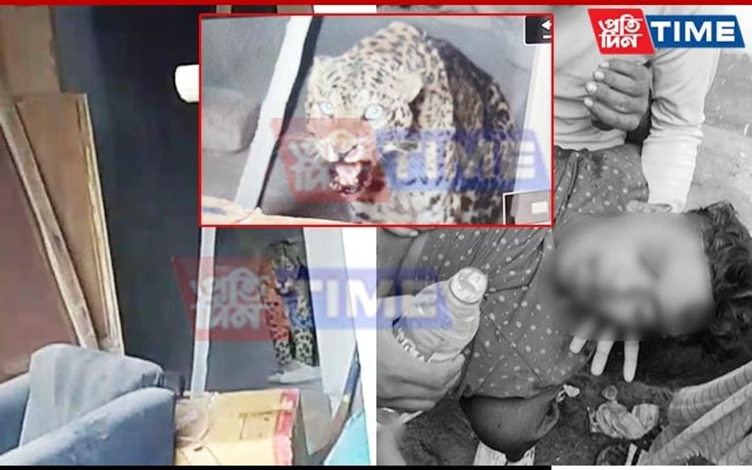 Guwahati Youth Injured In Leopard Attack