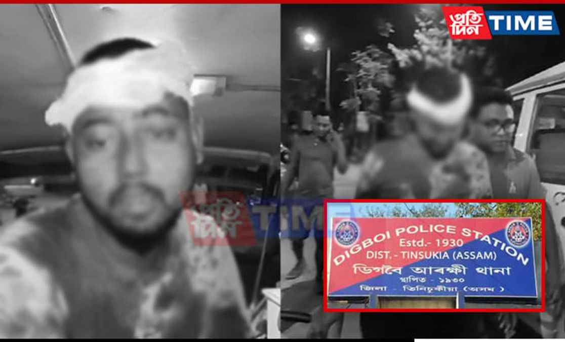 Family Dispute Escalates to Machete Attack in Assam's Digboi