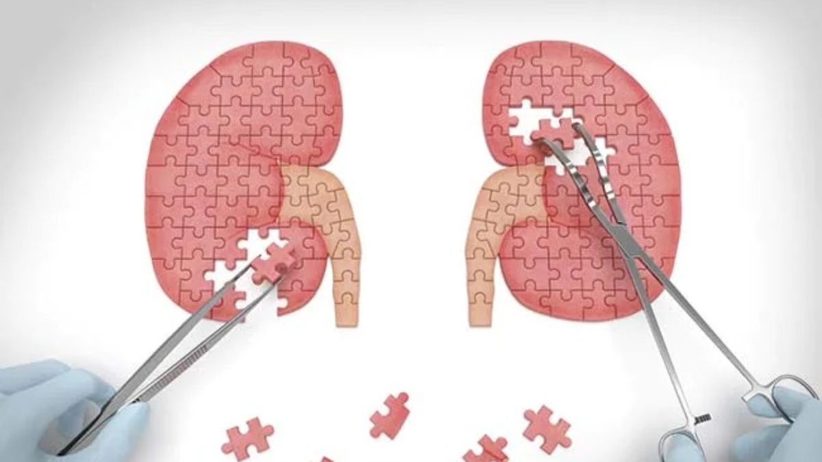 Kidney Racket: హైదరాబాద్ అడ్డాగా కిడ్నీ రాకెట్