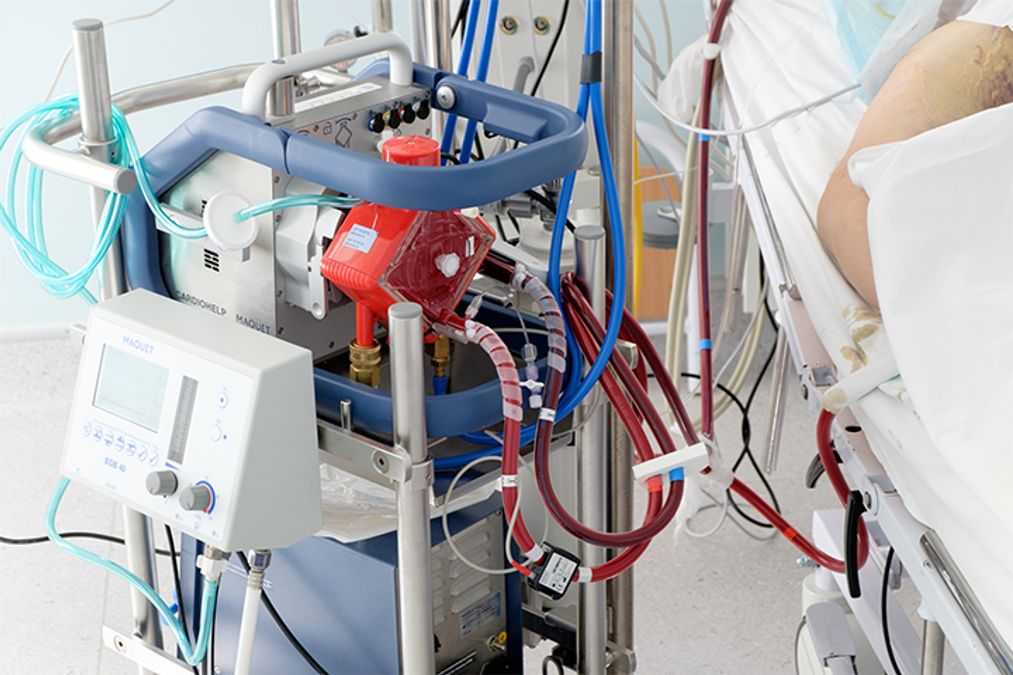 2 ECMO machines to be functional at SCB by July end