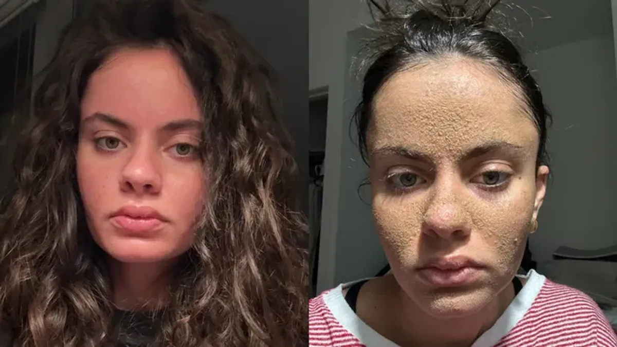 Woman Goes Viral For 'Caveman' Skincare Trend: What Is It About?