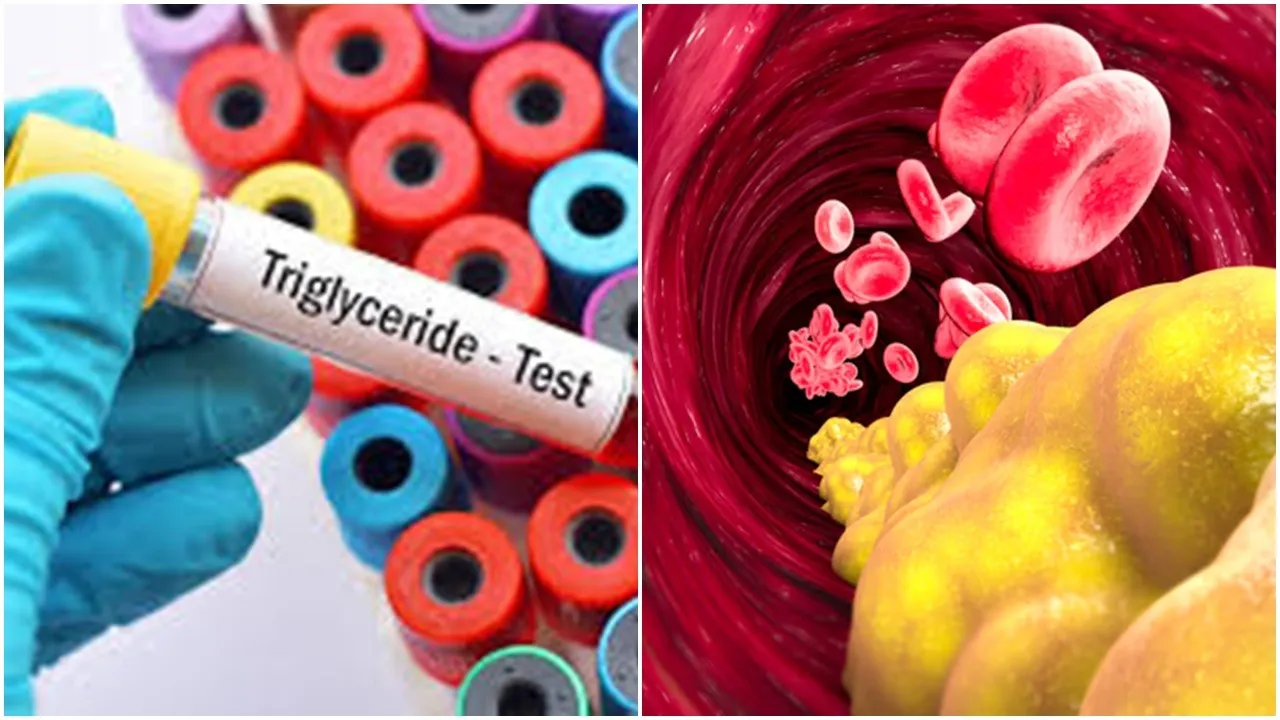 Triglycerides Lowering Foods: মাত্র ৭ দিনের মধ্যে ট্রাইগ্লিসারাইডের ...