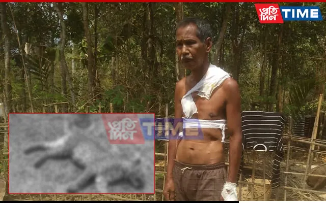 leopard attack human